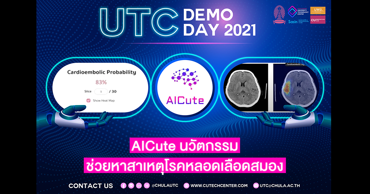 ' AICute ' นวัตกรรมช่วยหาสาเหตุโรคหลอดเลือดสมอง | BrandThink